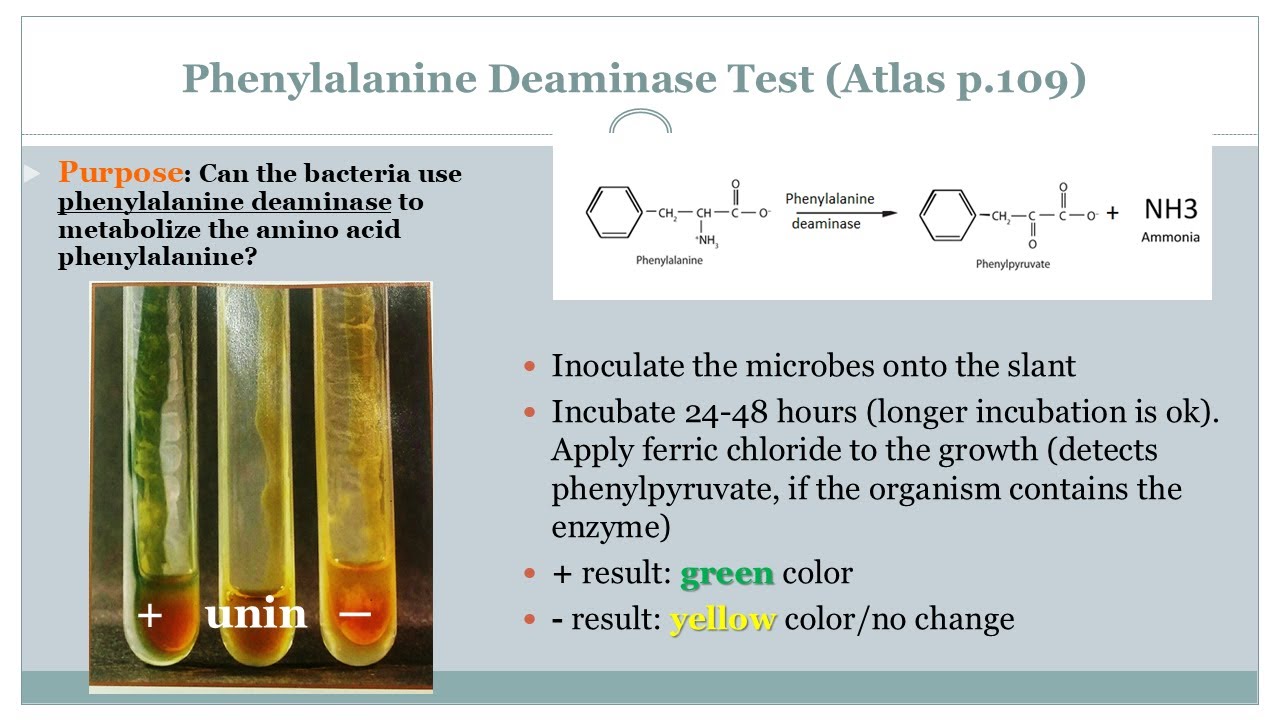 Phenylalanine Deaminase Test Microbiology Class Podcast Cc Youtube