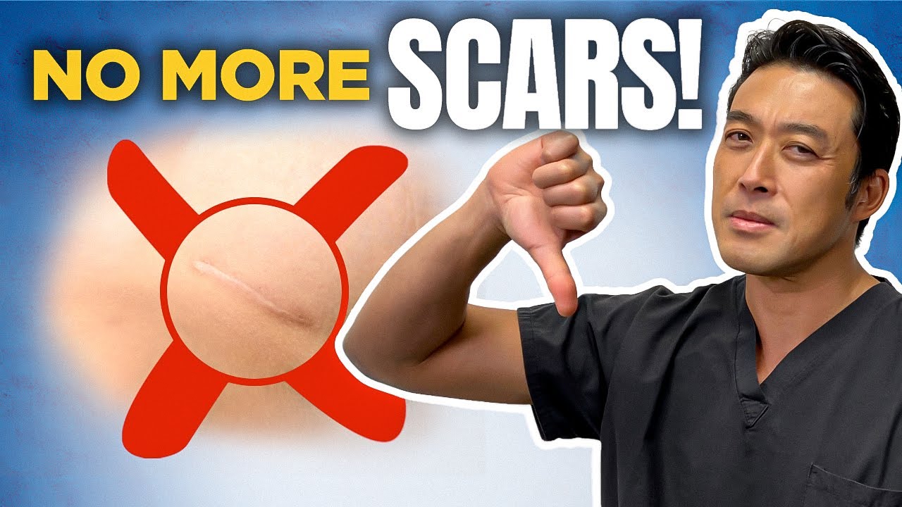 Watch This Tummy Tuck With A Hidden Scar Youtube