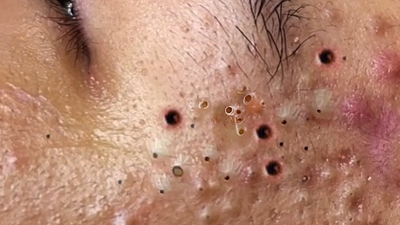 рќђђ рќђ рќђёрќђ рќђќрќђћрќђ рќђџрќђ рќђґ рќђѓрќђљрќђі 3530 Youtube